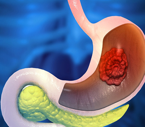 Citizens Speciality Hospital - duodenum