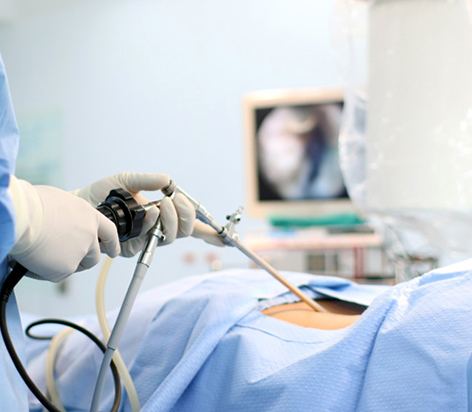 Basic Laparoscopic Procedures in Hyderabad | Citizens Specialty Hospital